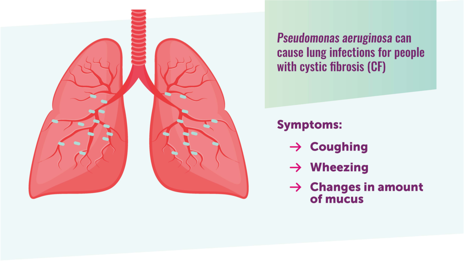 Pseudomonas Lung Infection Pseudomonas Lung Infection